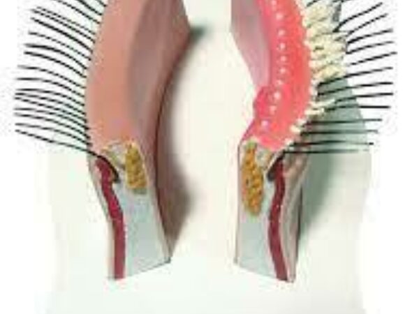 Mechanicsburg Eye | Welcome to the Dry Eye Center of Pennsylvania